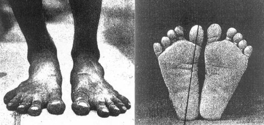 Vibram Five Fingers Shoes: The Barefoot Alternative - The Blog of ...